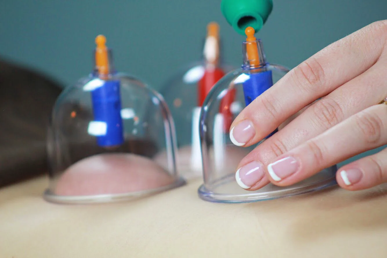 What Is Cupping Myo Austin Massage And Movement